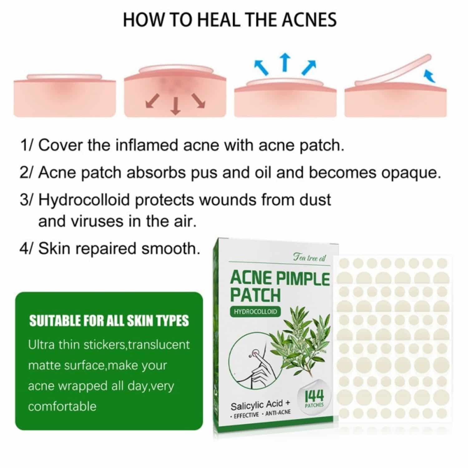 Acne Pimple Patch Hydrocolloid Stickers 144pcs for Overnight Spot ...