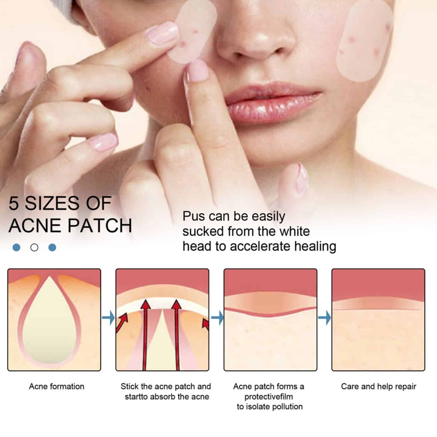 EELHOE Transparent Acne Patch - 80 Hydrocolloid Stickers for Acne ...