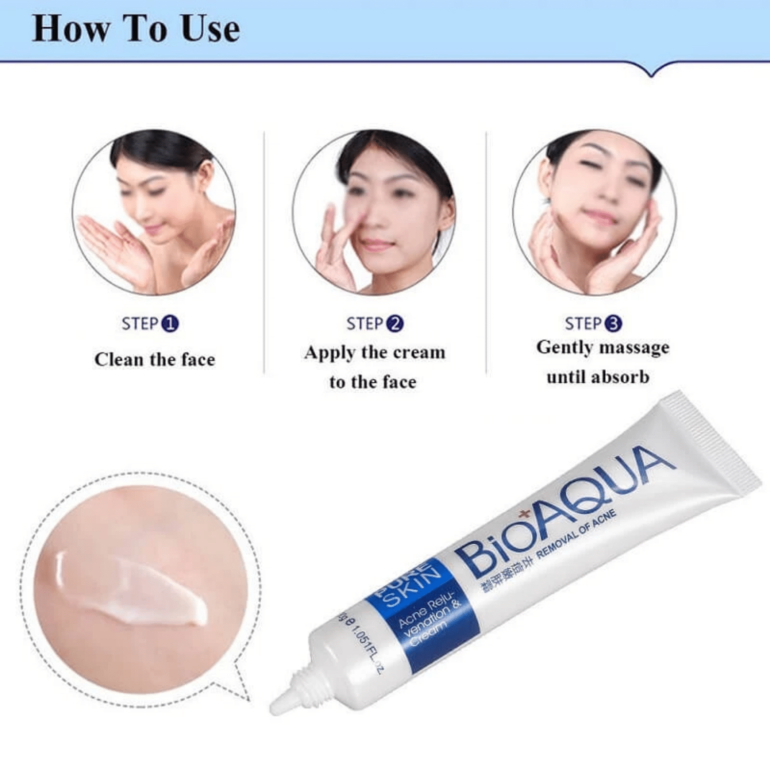 Acne Cream from Bioaqua helps to reduce acne and prevent marks