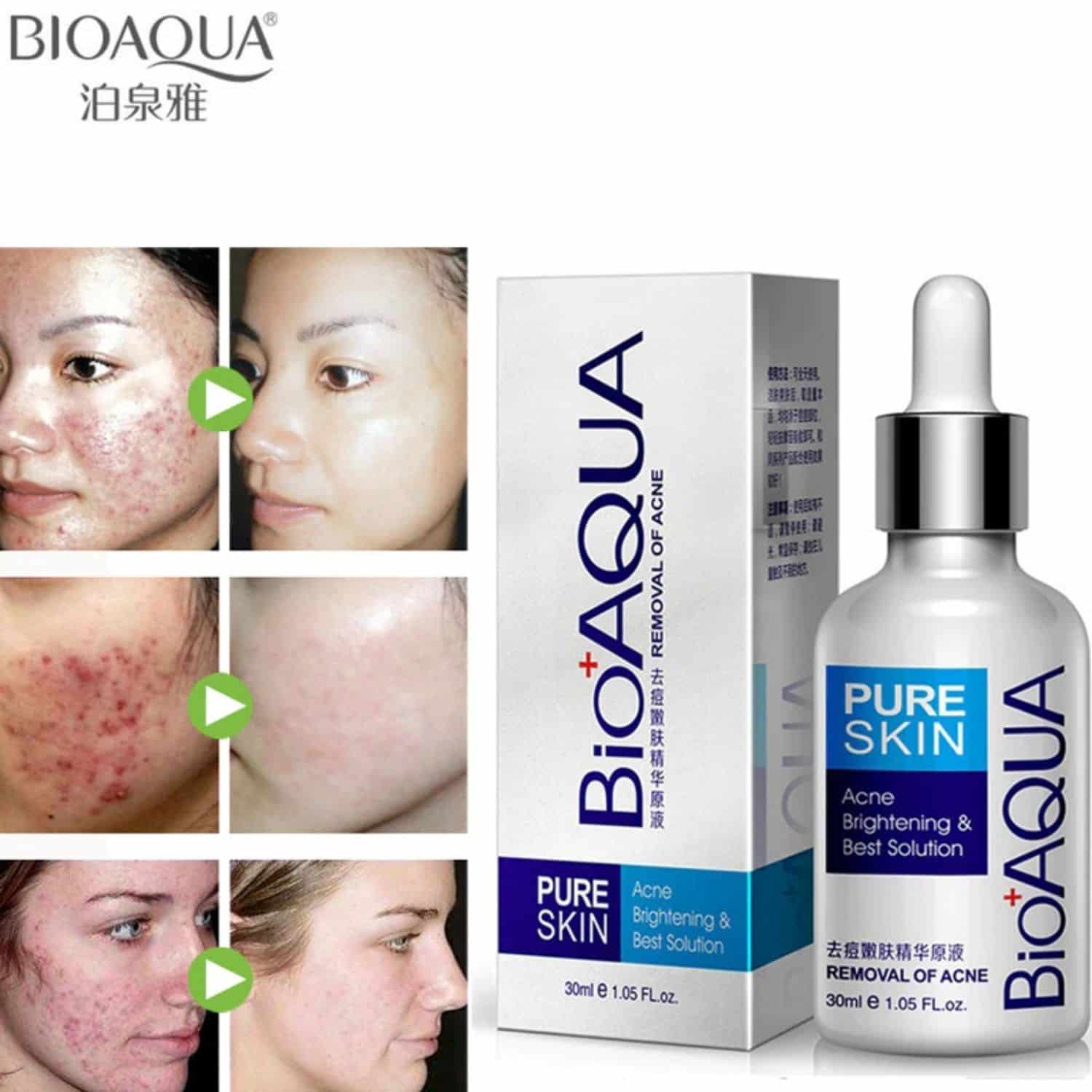 BIOAQUA Pure Skin Acne Treatment Serum - Clear, Bright, and Radiant ...